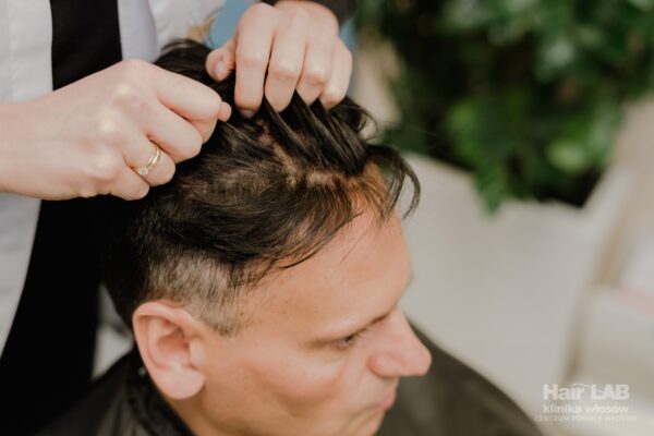 Tupety męskie i damskie z włosów naturalnych | Hair LAB